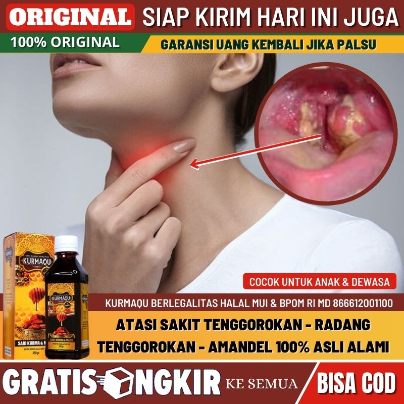 Jual Obat Radang Tenggorokan Untuk Anak & Dewasa 100% Alami - Obat Sakit Tenggorokan, Mulut Bau ...