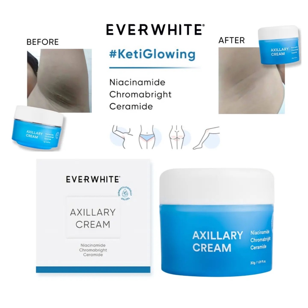 Jual EVERWHITE Axillary UnderArm Cream / Pemutih Ketiak & Area Lipatan ...
