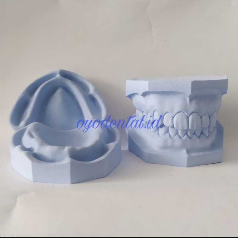 Dental model study gips / model gigi gips / model study gipsum gypsum ...