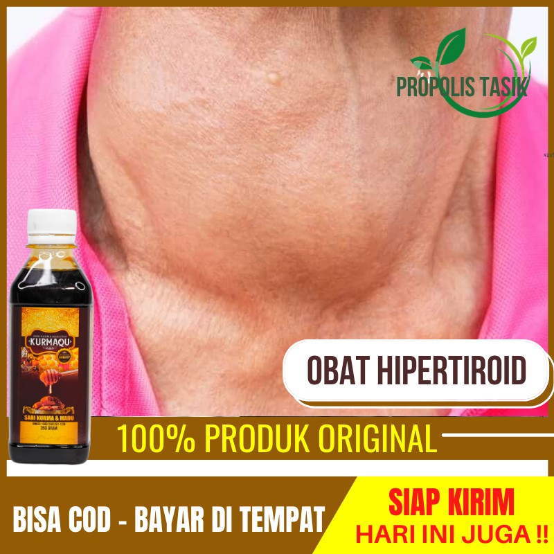 Jual Obat Hipertiroid Tiroid Bengkak Gondok Beracun Benjolan Di Leher ...