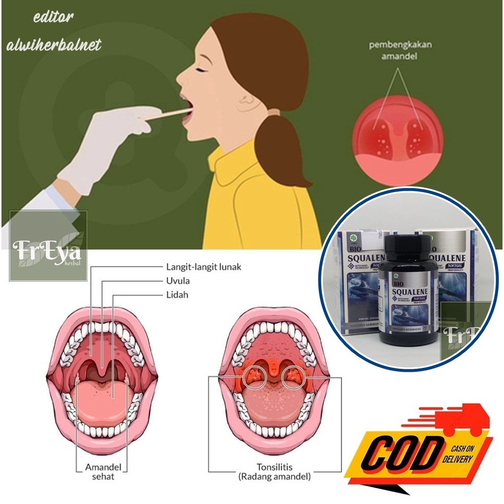 Jual OBAT AMANDEL | OBAT RADANG AMANDEL | OBAT PEMBENGKAKAN KELENJAR ...