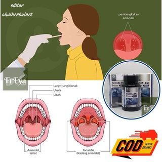 Jual OBAT AMANDEL | OBAT RADANG AMANDEL | OBAT PEMBENGKAKAN KELENJAR ...