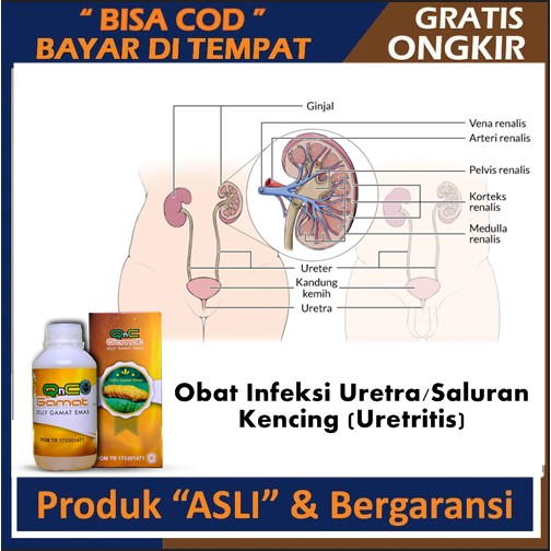 Jual Obat Infeksi Uretra/Saluran Kencing (Uretritis), Infeksi Salurah ...