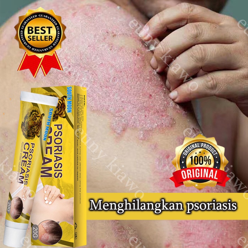 Jual Salep gatal Salep Eksim Salep kulit Krim psoriasis paling ampuh ...