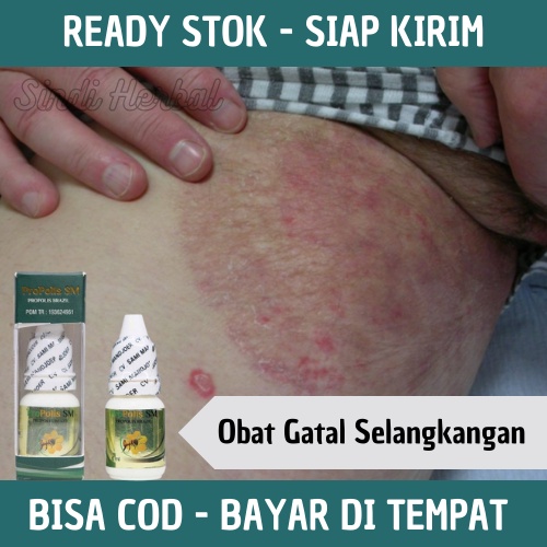 Jual Obat Gatal Selangkangan, Obat Selangkangan Gatal Dan Hitam, Obat ...