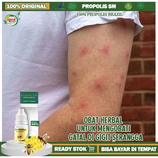 Jual Obat Gatal Di Gigit Seranggan, Obat Masalah Kulit Gatal, Atasi ...