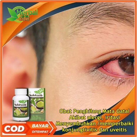 Jual Obat Penghilang Mata Gatal Akibat Alergi, Iritasi Pada Mata Karena ...