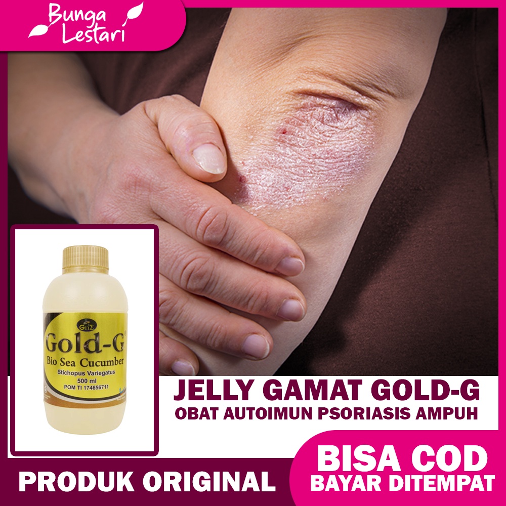 Jual Obat autoimun kulit psoriasis, lupus, terbaik | Shopee Indonesia