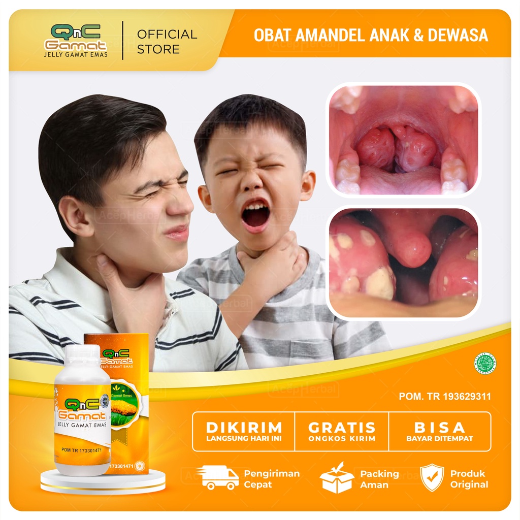 Jual Obat Amandel Anak Dan Dewasa - Radang Amandel di Tenggorokan Sakit Dan Susah Menelan ...