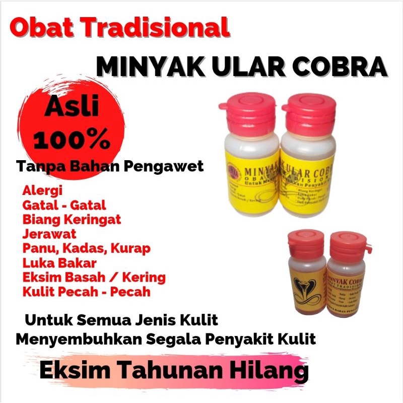 Jual Minyak Ular Cobra/Obat Gatal/Obat Eksim/Obat Jerawat/Obat Alergi ...