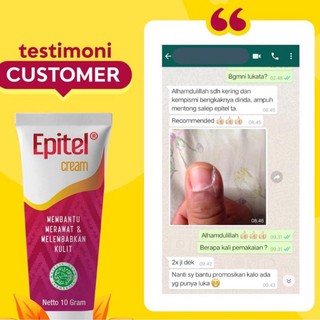 Jual epitel cream 50gr Indonesia|Shopee Indonesia