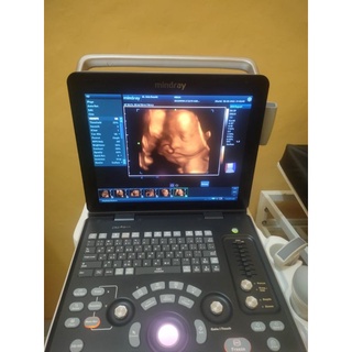 Jual USG mobile color doppler 4D(4probe) | Shopee Indonesia