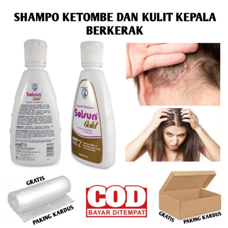 Jual SHAMPO KETOMBE DAN KULIT KEPALA BERKERAK | Shopee Indonesia