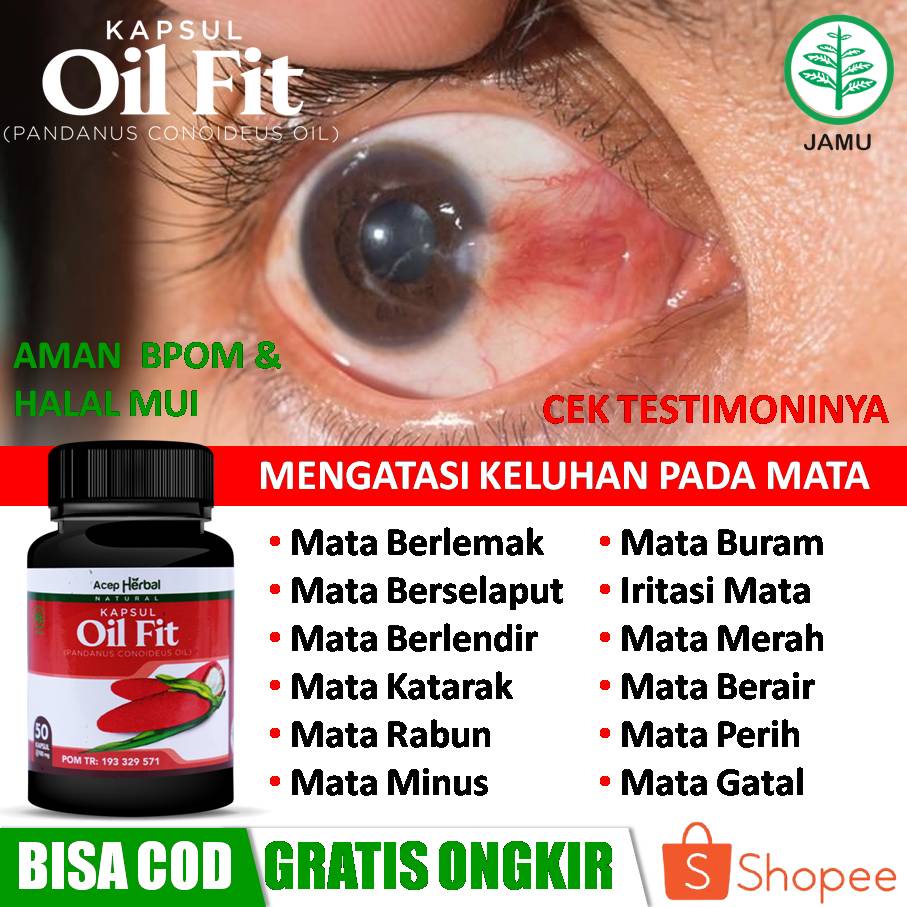 Jual Obat Mata Berlemak, Penghilang Selaput Di Mata, Pembersih Mata ...