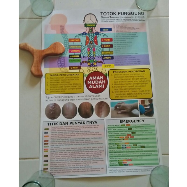 Jual poster + alat terapi totok punggung, refleksi kaki,dll dari kayu ...