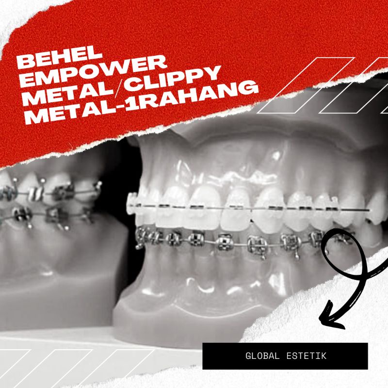Jual Behel Empower Metal/Clippy Metal - 1 Rahang | Shopee Indonesia