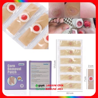 Jual Obat Kutil Kapalan Mata Ikan Kaki/Plester Penghilang Kutil Mata ...