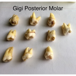 Jual Gigi asli manusia gigi posterior gigi molar utk praktikum | Shopee ...