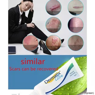Jual Dermatix Ultra Gel Salep Penghilang Luka 15Gr Advanced Scar ...