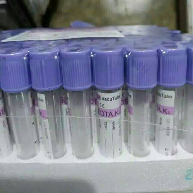 Tabung EDTA / Tabung Ungu | Shopee Indonesia