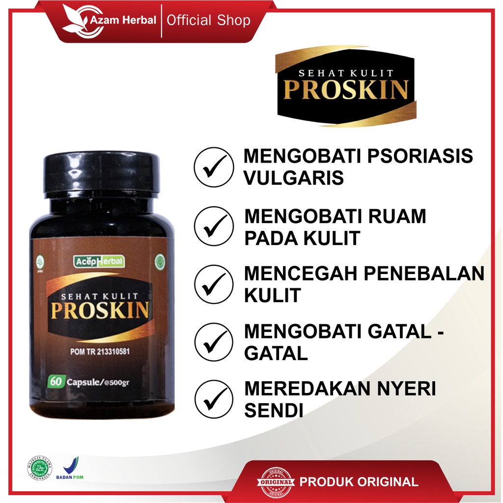 Jual Obat Psoriasis Vulgaris Kulit Kepala Gatal Bersisik Di Ketiak Selangkangan Dan Kuku Sehat ...