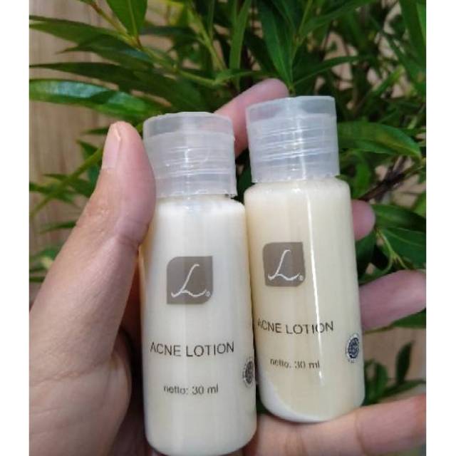 Jual ACNE LOTION Larissa Obat jerawat by Larissa (FREE GIFT min ...