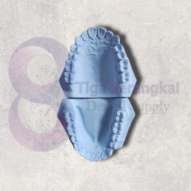 Jual Dental Model Gigi Stone Gips Lengkap / Model Study Edentulus ...