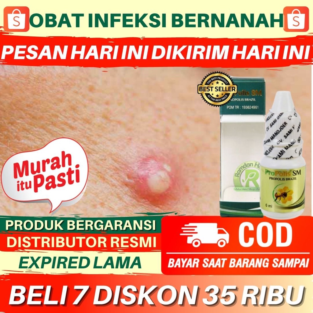 Jual Obat Infeksi Bernanah | Infeksi Luka | Telinga Bernanah | Luka ...