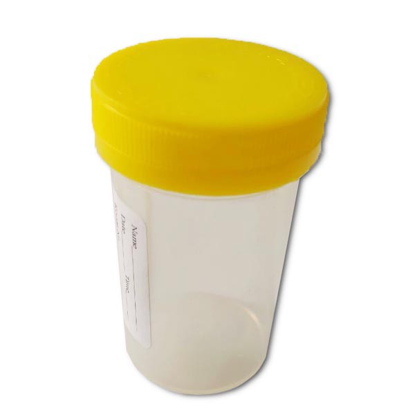 Jual Pot Urin 25 pcs - Wadah Sample Urine / Urine Container Indonesia ...