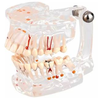 Jual DENTAL MODEL GIGI TYPODONT phantom gigi Kedokteran gigi Indonesia ...