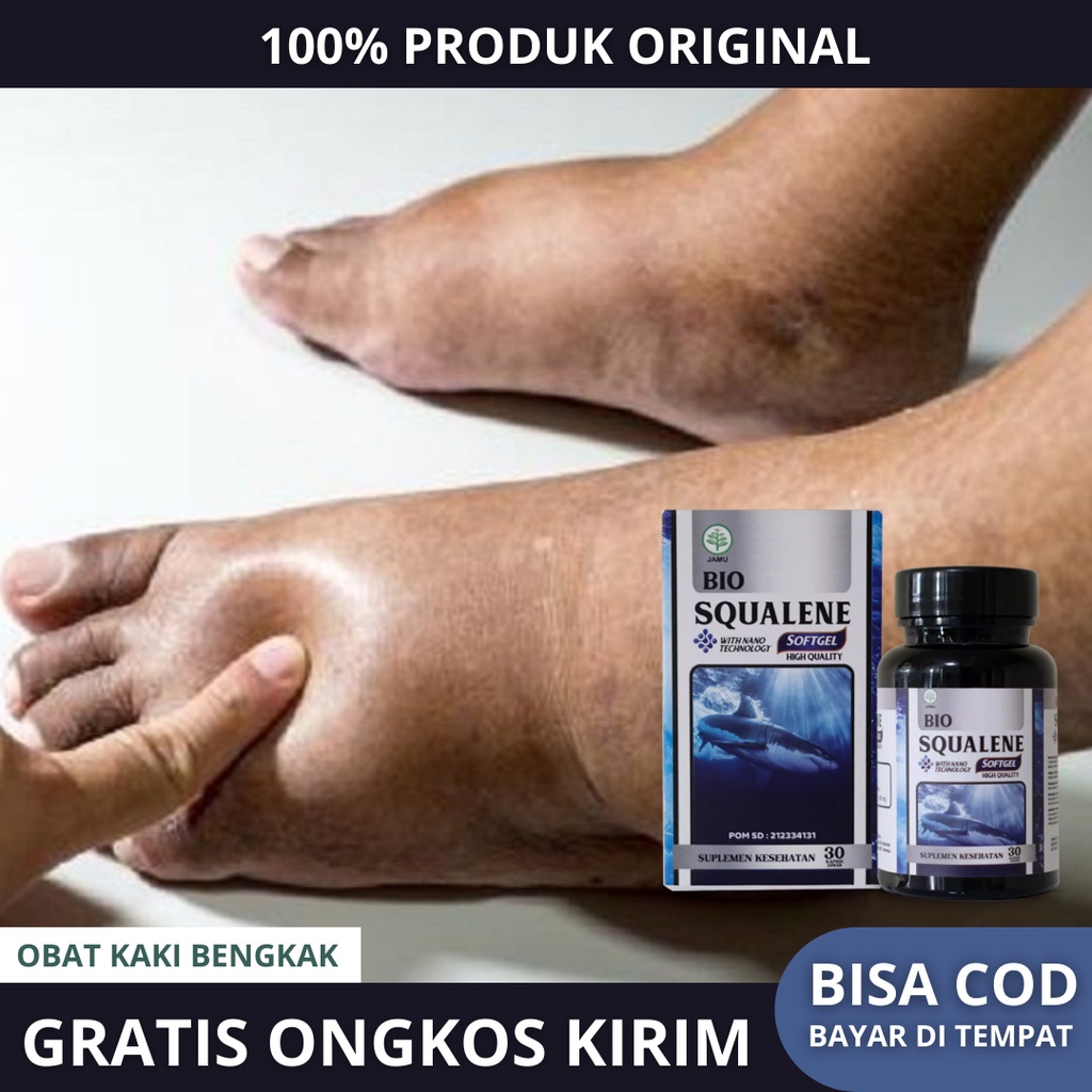 Jual Obat Kaki Bengkak Terlengkap & Harga Terbaru Februari 2023 ...