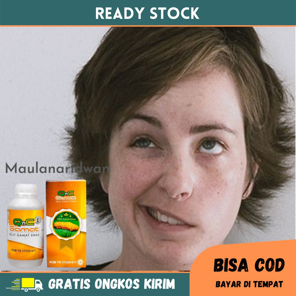 Obat Bells Palsy, Saraf Wajah Rusak, Belpasi, Bibir Moncong/Miring ...