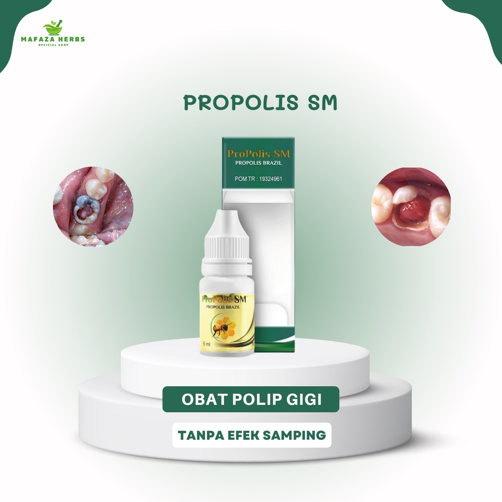 Jual Mafaza Herbs - Obat Polip Gigi, Obat Polip Pulpa, Obat Abses Gigi ...