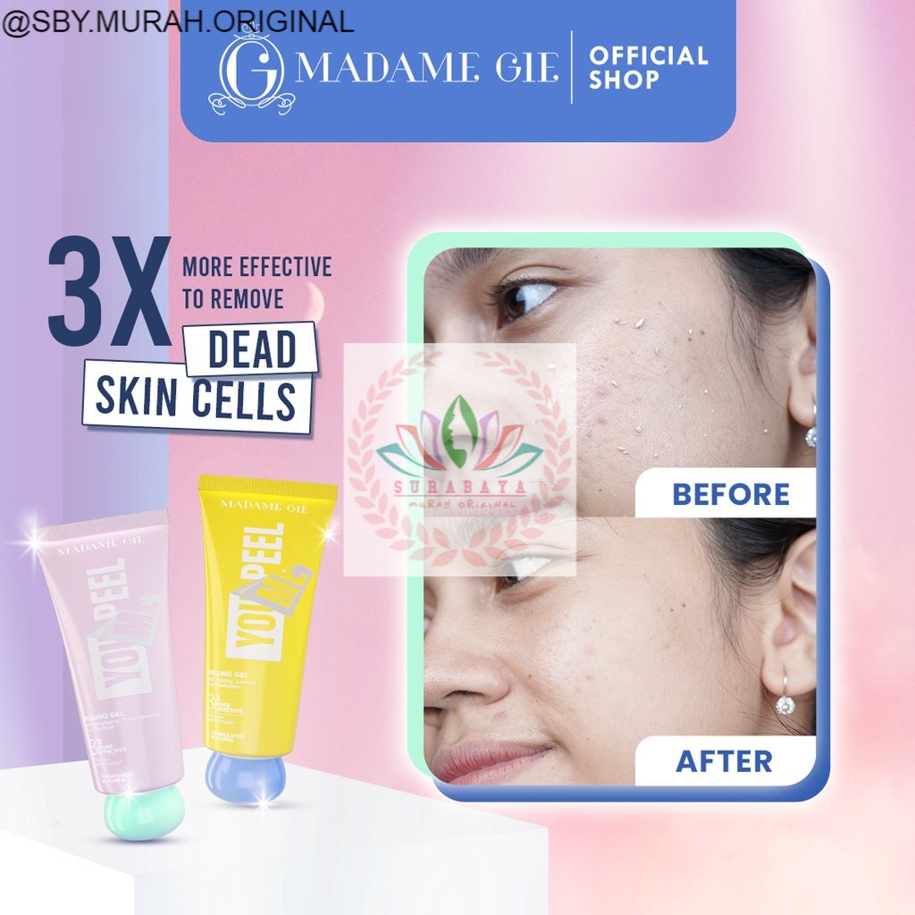 Jual Madame Gie Madame You Peel Me - Peeling Gel IPerontok Daki dan Ketiak Hitam I Peeling dan ...