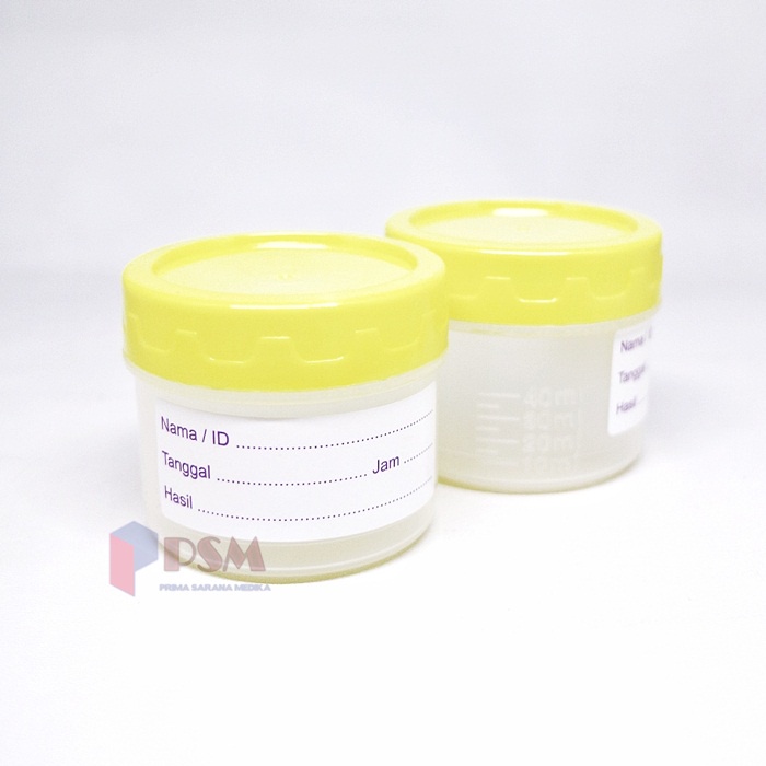 Jual Urine Container Non Steril 60ml / Pot Urin / Sputum Pot | Shopee ...