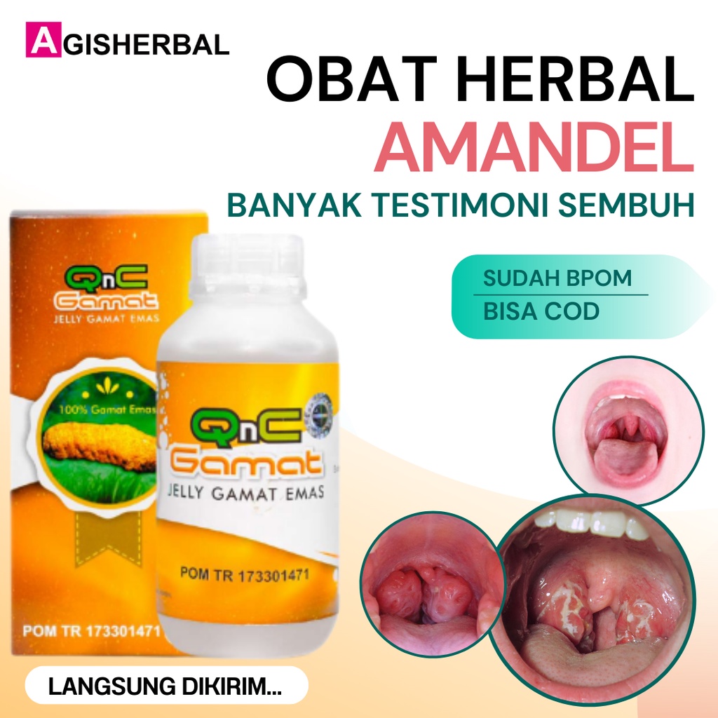 Jual Obat Amandel Anak Dan Dewasa Qnc Jelly Gamat Emas Asli 100% ...