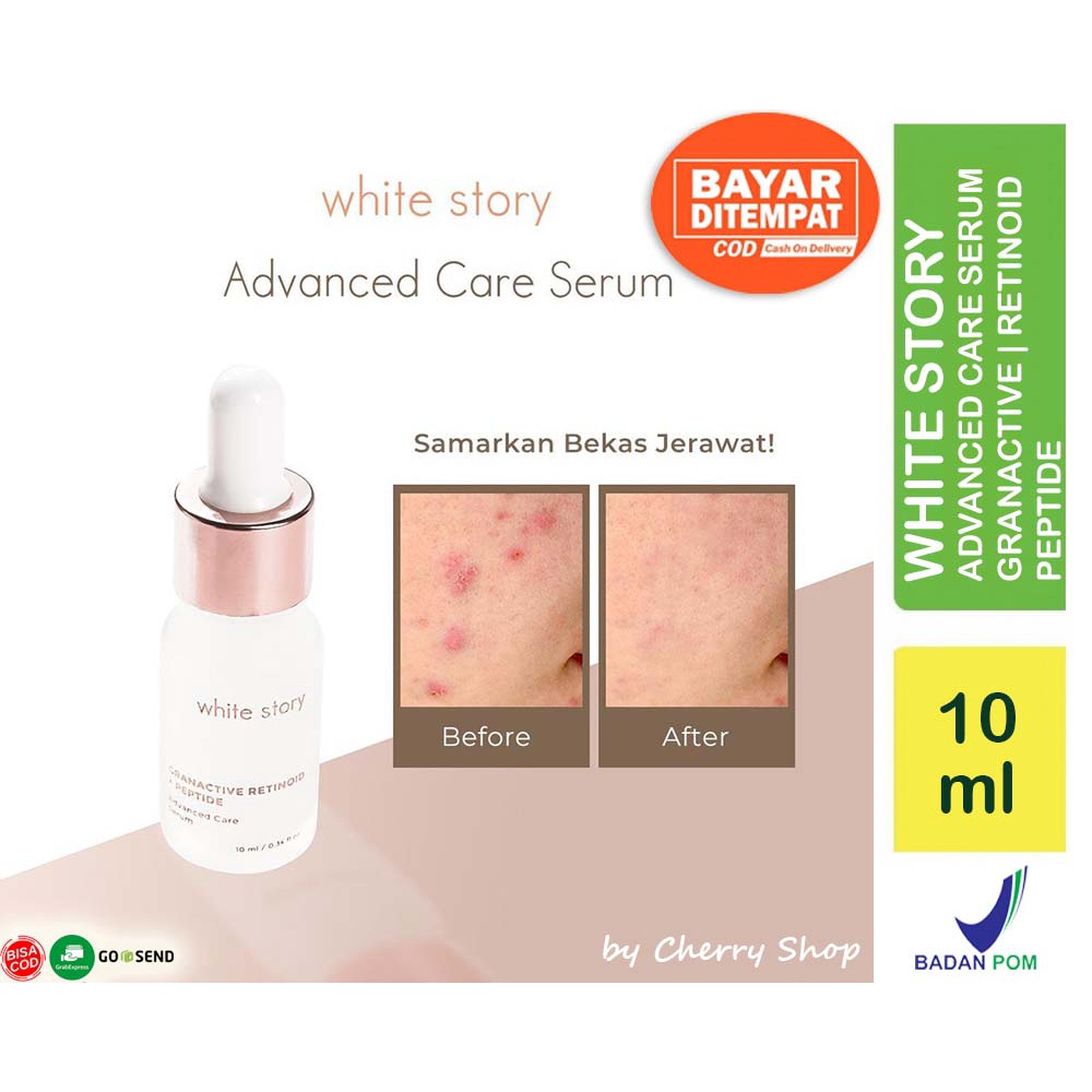 Jual [SAMARKAN BEKAS JERAWAT & NODA HITAM] [10ML] [BPOM] White Story ...