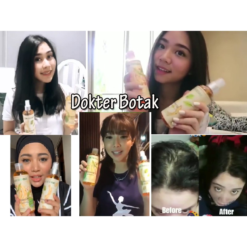 Jual Dokter Botak Bioherbal (Paket Shampo dan Tonik) | Atasi kebotakan ...