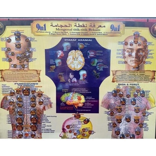Jual Poster Bekam Petunjuk Titik Titik Bekam Yang Harus Di Ke Sitdyo ...