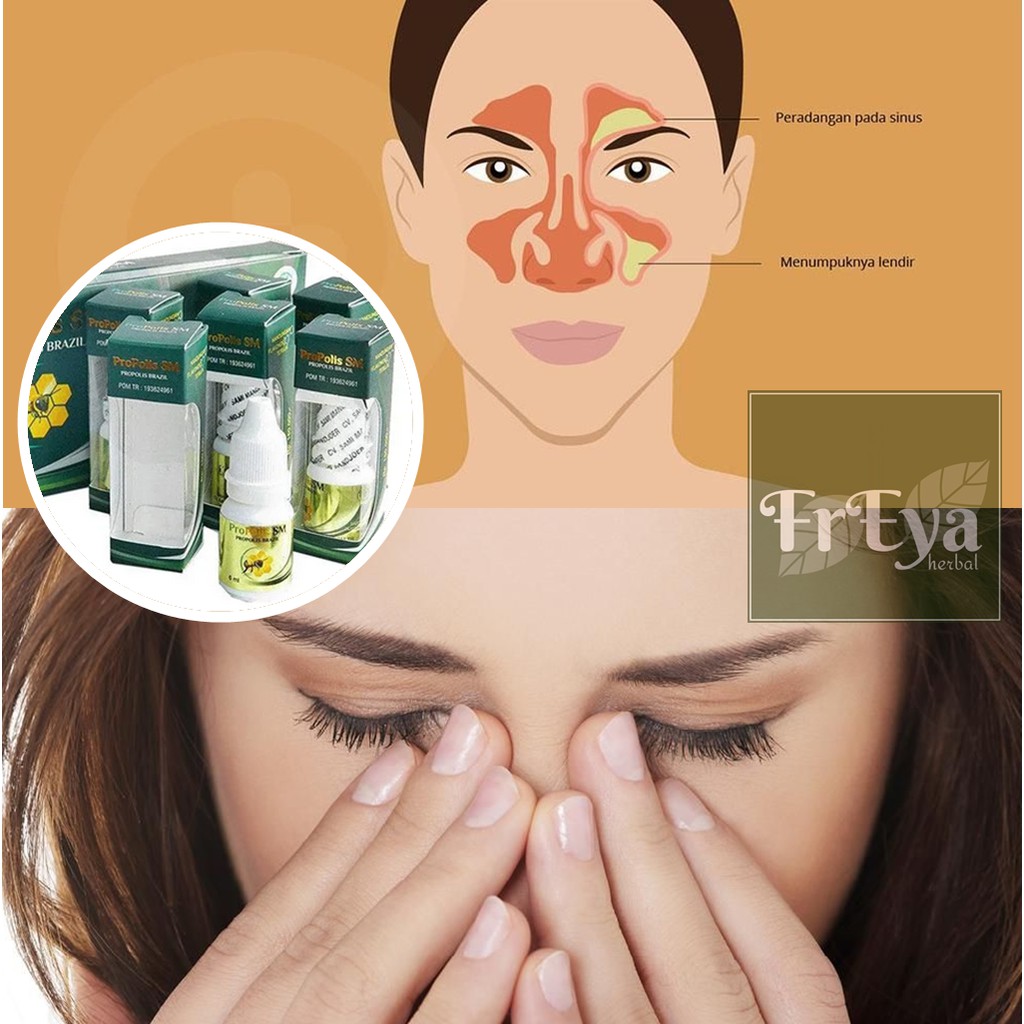Jual OBAT SINUSITIS, OBAT RADANG SINUS, OBAT INFEKSI SINUS, OBAT ...