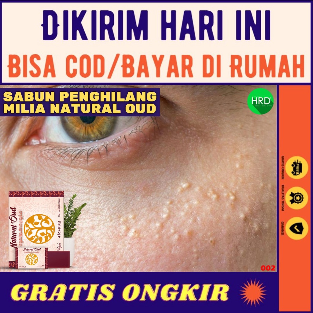 Jual Sabun Penghilang Milia - Natural Oud - Bruntusan Kecil di Wajah ...