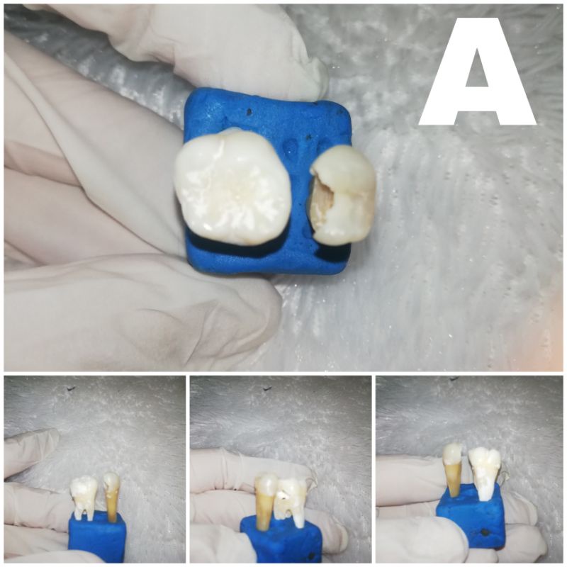 Jual GIGI INSISIVUS, PREMOLAR, MOLAR PRAKTIKUM Indonesia|Shopee Indonesia