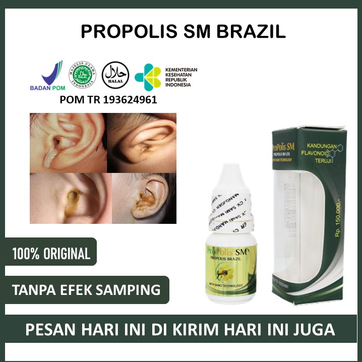 Jual Obat Telinga Bernanah, Congek, Curek, Telinga Berair, Infeksi ...