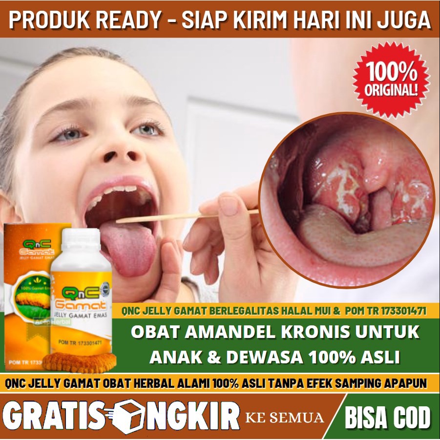 Jual Obat Tonsil Radang Amandel 100% Herbal Alami, Solusi Tradisional ...