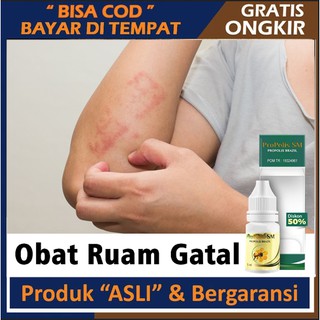 Jual Obat Ruam Gatal, Berair, Kemerahan, Melingkar di Area Kaki Tangan ...