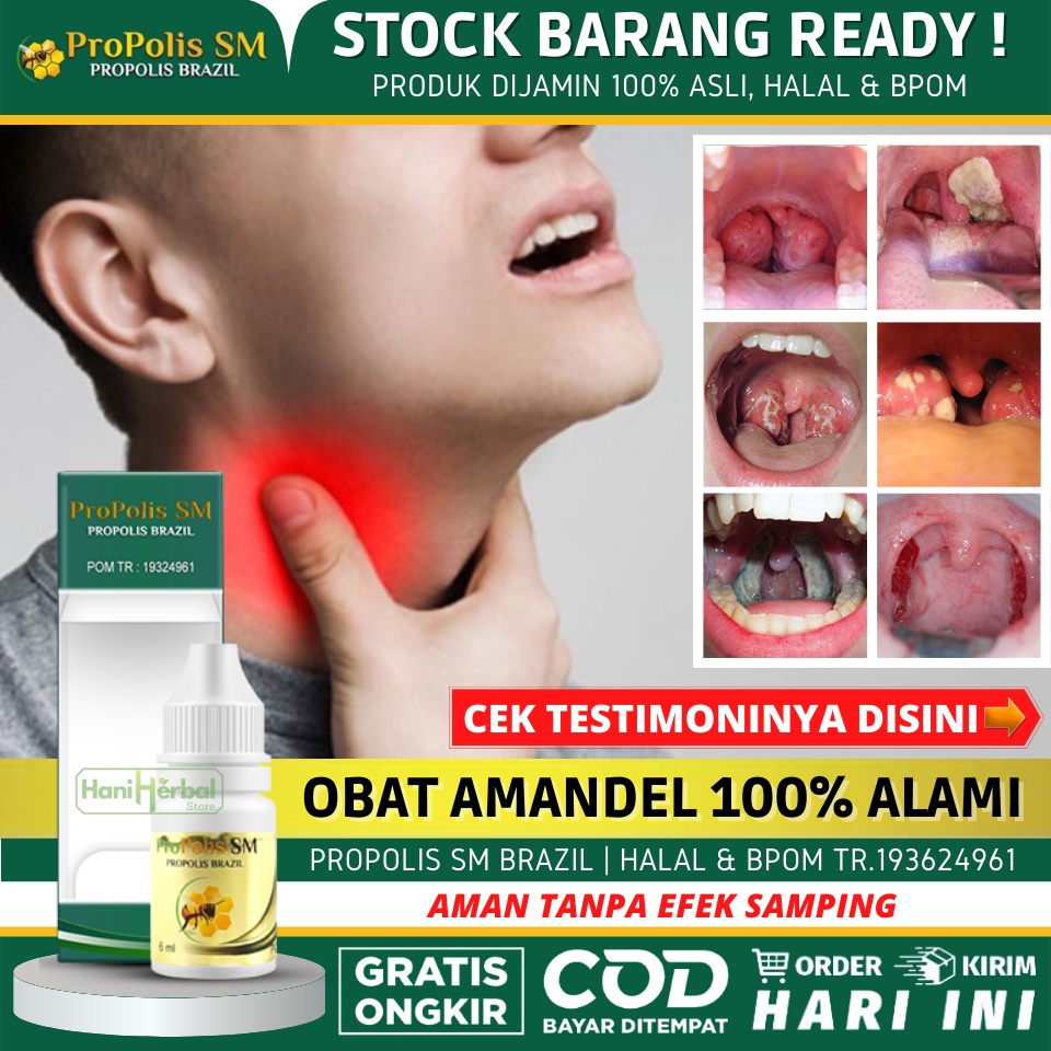 Jual OBAT AMANDEL HERBAL UNTUK ANAK & DEWASA - RADANG TENGGOROKAN - OBAT AMANDEL BENGKAK ...