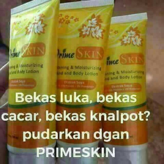 Jual PRIME SKIN LOTION(herbal untuk kulit mengandung soya) | Shopee ...