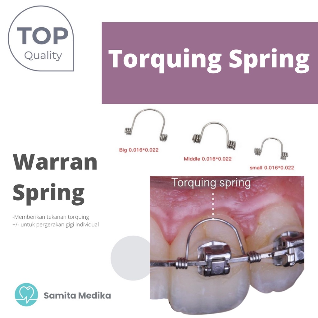 Jual Dental Torque Spring Labial Lingual Root Torquing Orthodontic | Shopee Indonesia