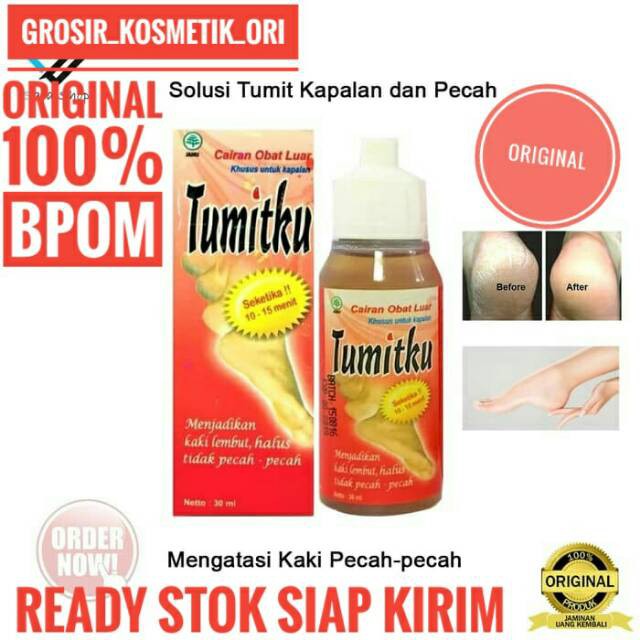 TUMITKU MENGATASI KAKI PECAH - KAPALAN DENGAN INSTAN 30ml | Shopee ...
