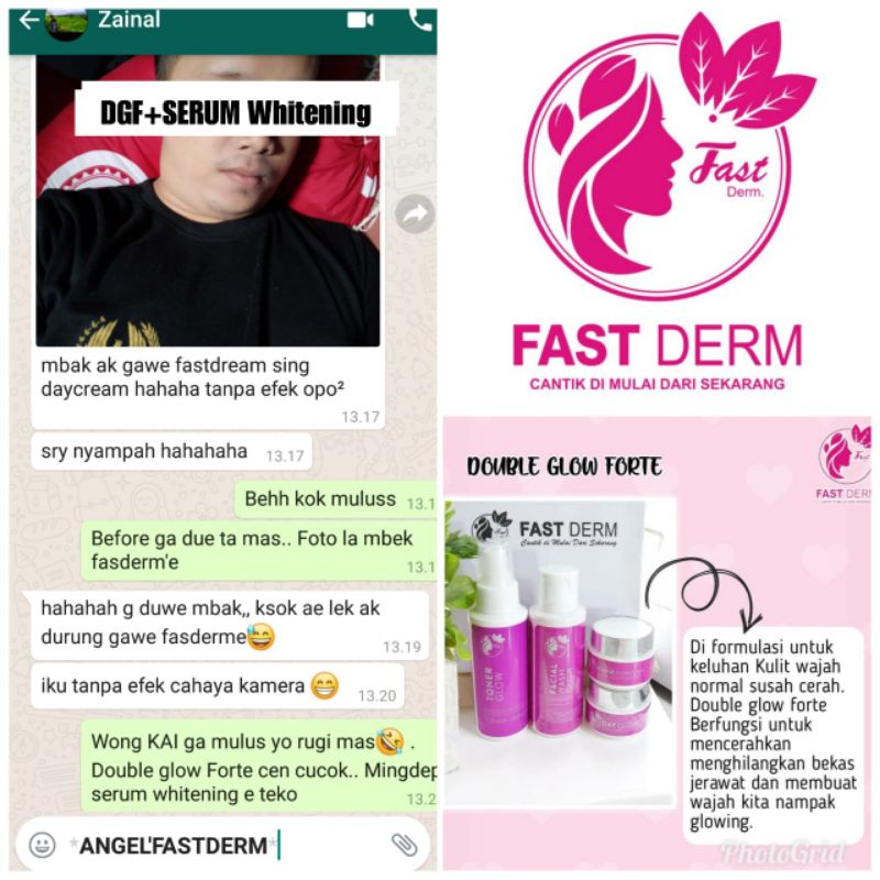 Jual FAST DERM Double glow FORTE | Shopee Indonesia